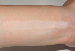 Why Make-Up Flashback Happens and How to Avoid It | Lab Muffin Beauty ...