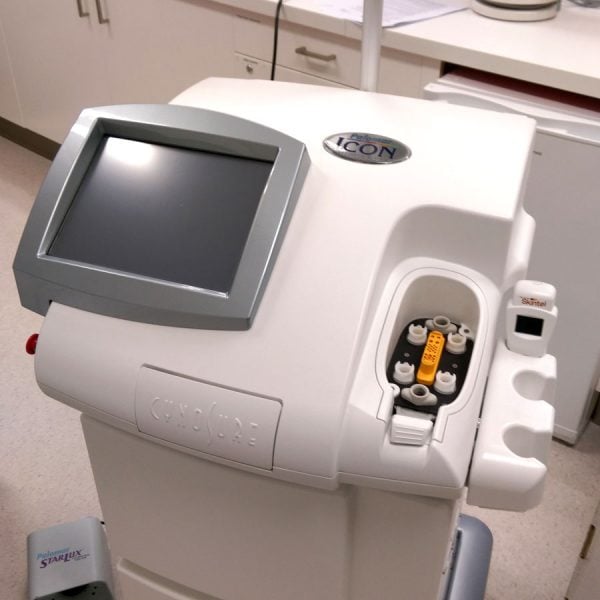 IPL Treatment for Broken Capillaries (Cynosure Icon) | Lab Muffin ...