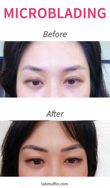 Eyebrow Microblading: How It Works and Before & After | Lab Muffin ...