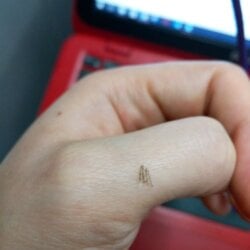 Eyebrow Microblading: How It Works and Before & After | Lab Muffin ...