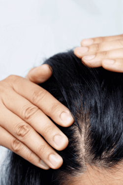 Amodimethicone: The Science of My Favourite Hair Ingredient | Lab ...