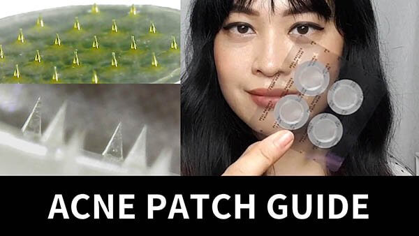 Guide to Acne Patches: Hydrocolloid, Treatment, Microneedle (Video ...