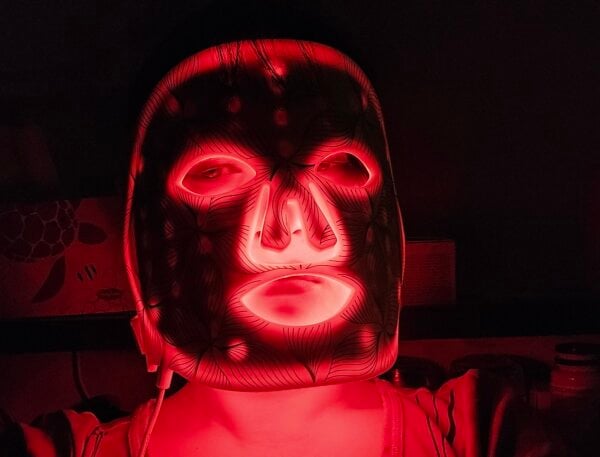 Is red light safe for hyperpigmentation and melasma? | Lab Muffin ...